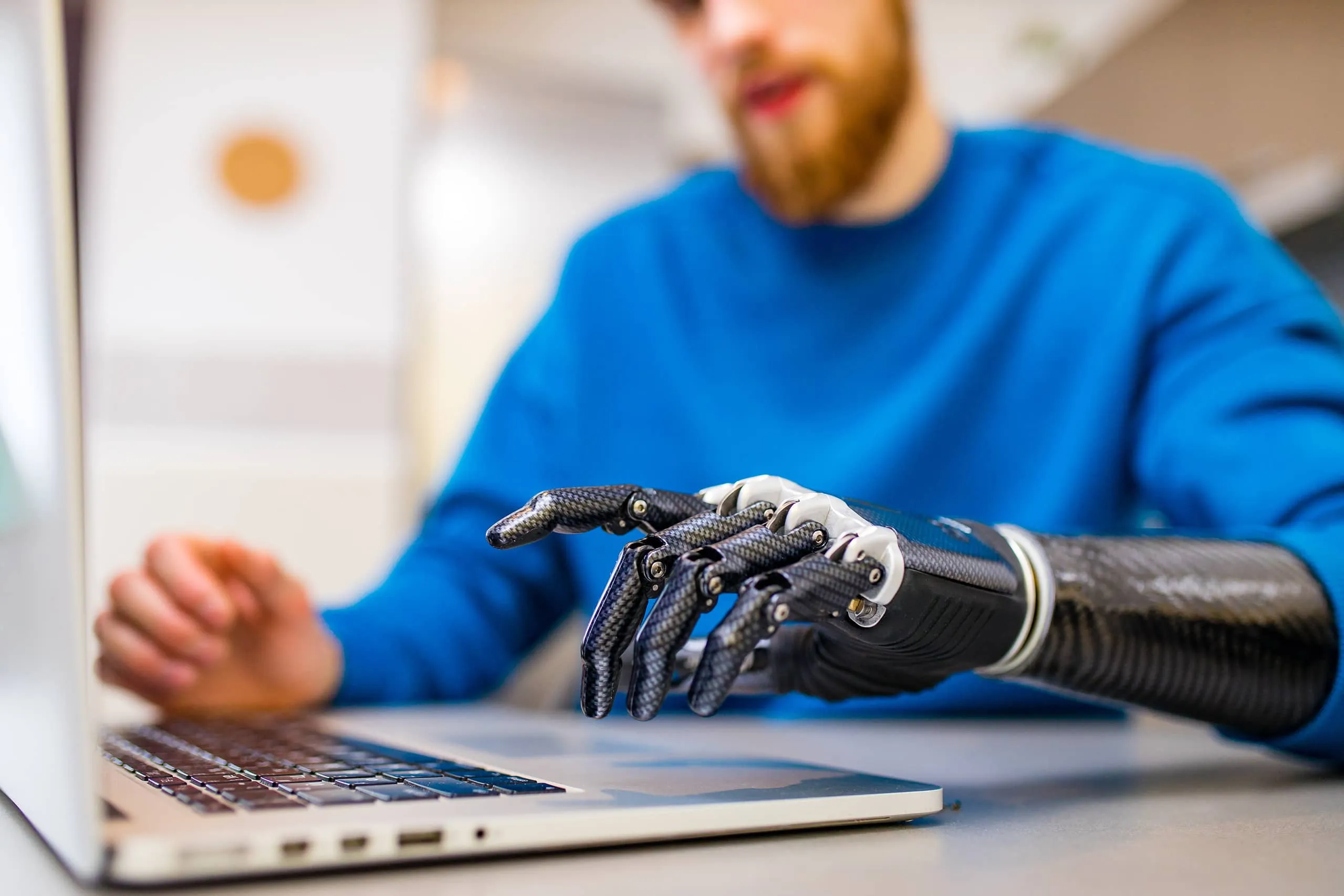 From Prosthetics to Archaeology: 3D Scanning Changes Lives | Digitize ...
